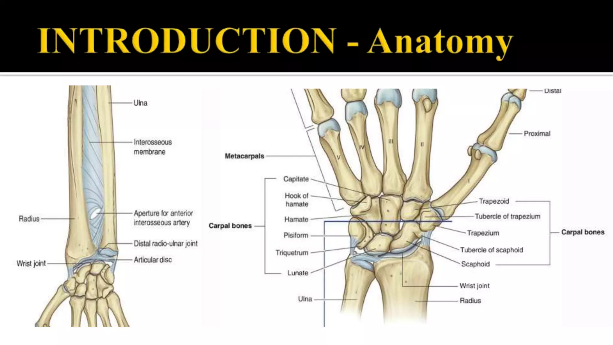 Distal radius fracture | PPTX