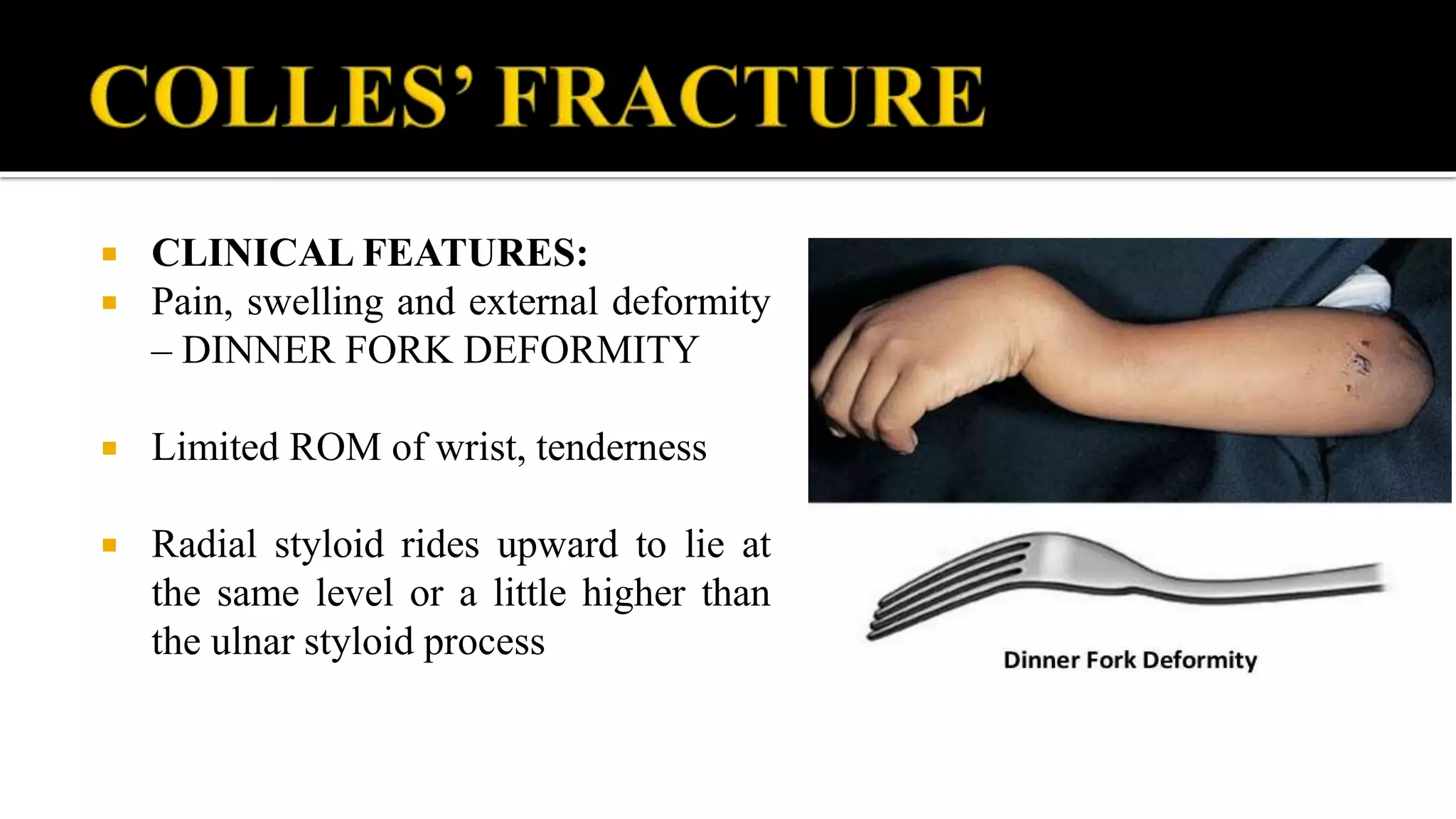 Distal radius fracture | PPTX