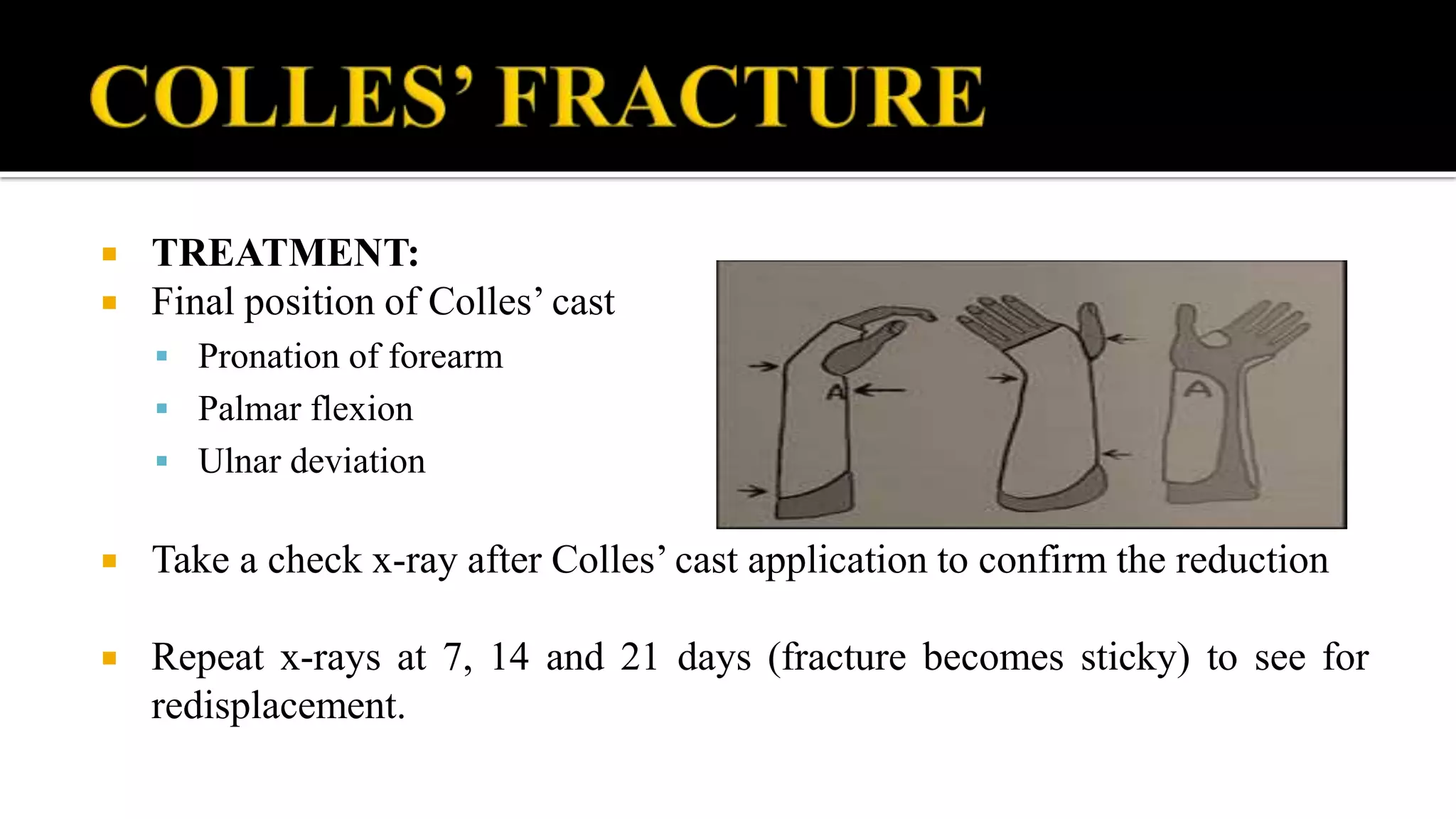 Distal radius fracture | PPTX