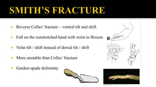 Distal radius fracture | PPTX