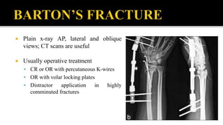 Distal radius fracture | PPTX