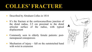 Distal radius fracture | PPTX