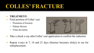 Distal radius fracture | PPTX