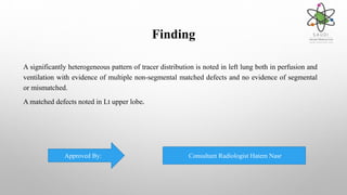 Pulmonary Ventilation and Perfusion Scan | PDF