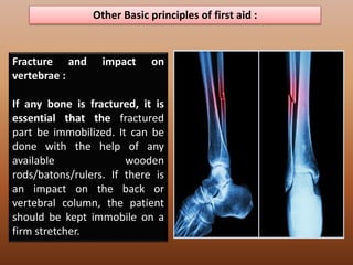 9.3 disaster management | PPTX
