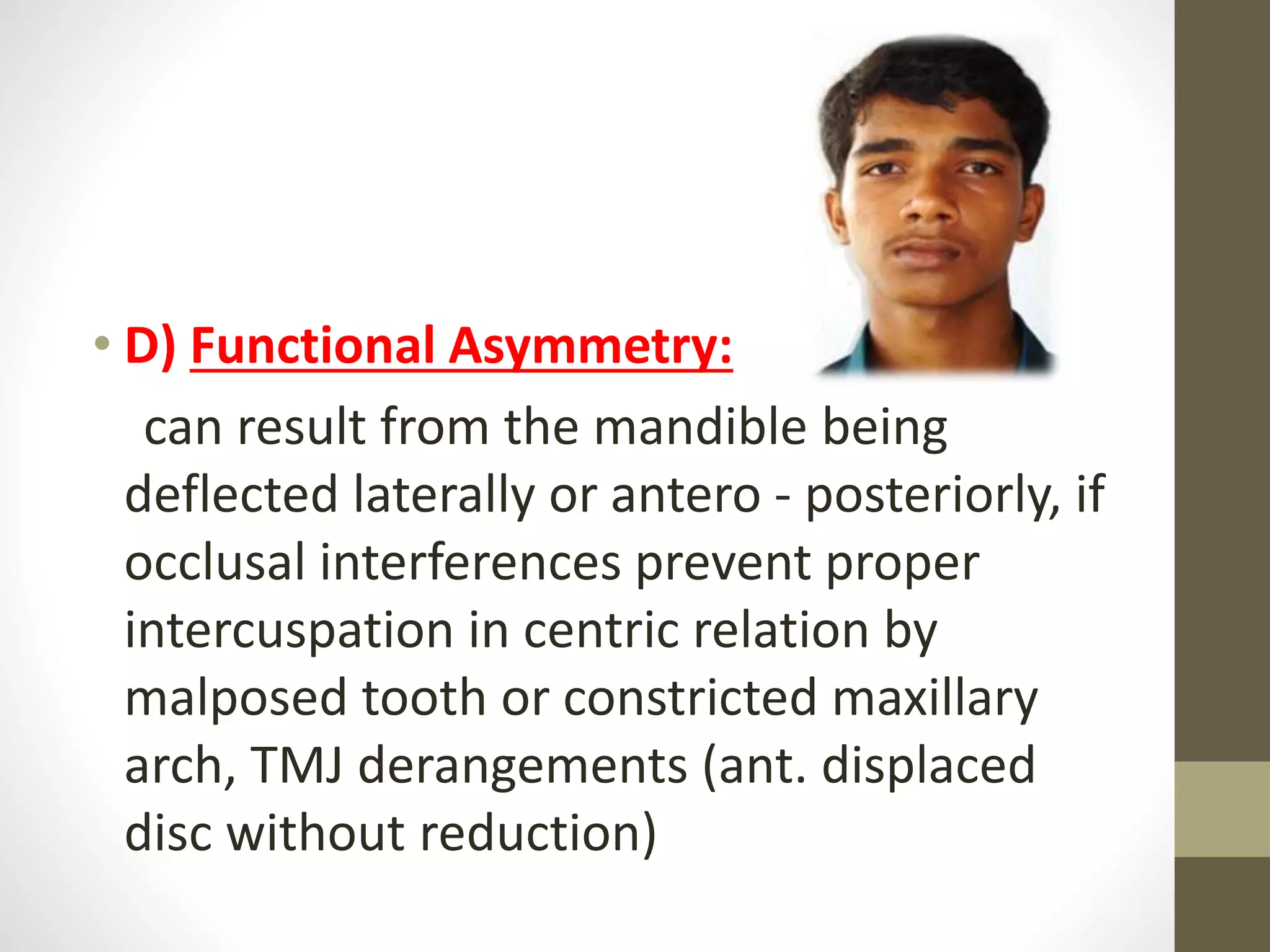 ETIOLOGY AND DIAGNOSIS OF FACIAL ASYMMETRY | PPTX