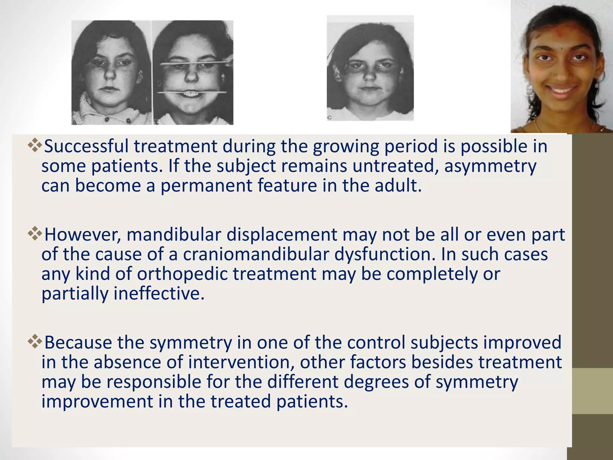 ETIOLOGY AND DIAGNOSIS OF FACIAL ASYMMETRY | PPTX