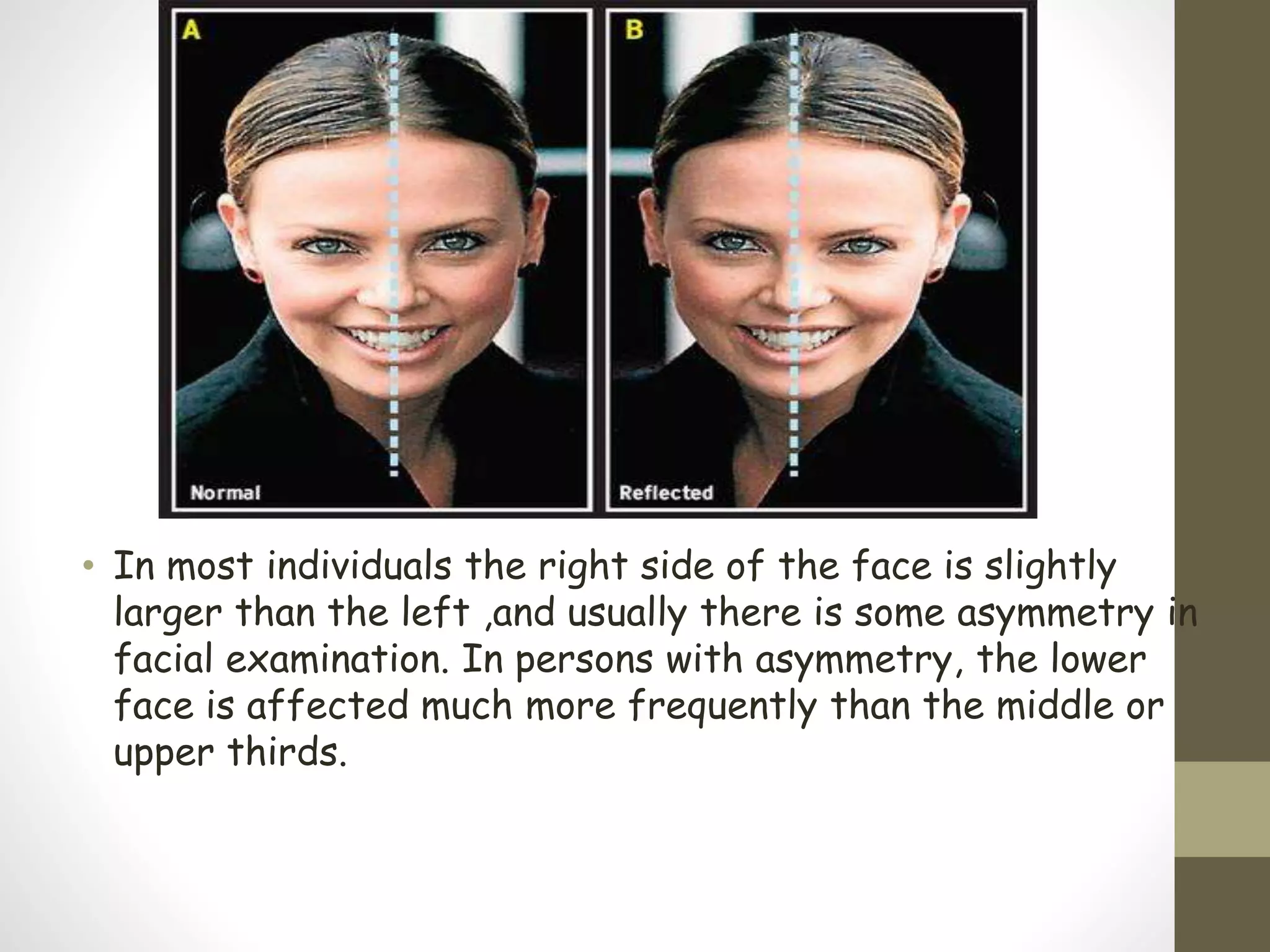 ETIOLOGY AND DIAGNOSIS OF FACIAL ASYMMETRY | PPTX