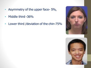 ETIOLOGY AND DIAGNOSIS OF FACIAL ASYMMETRY | PPTX