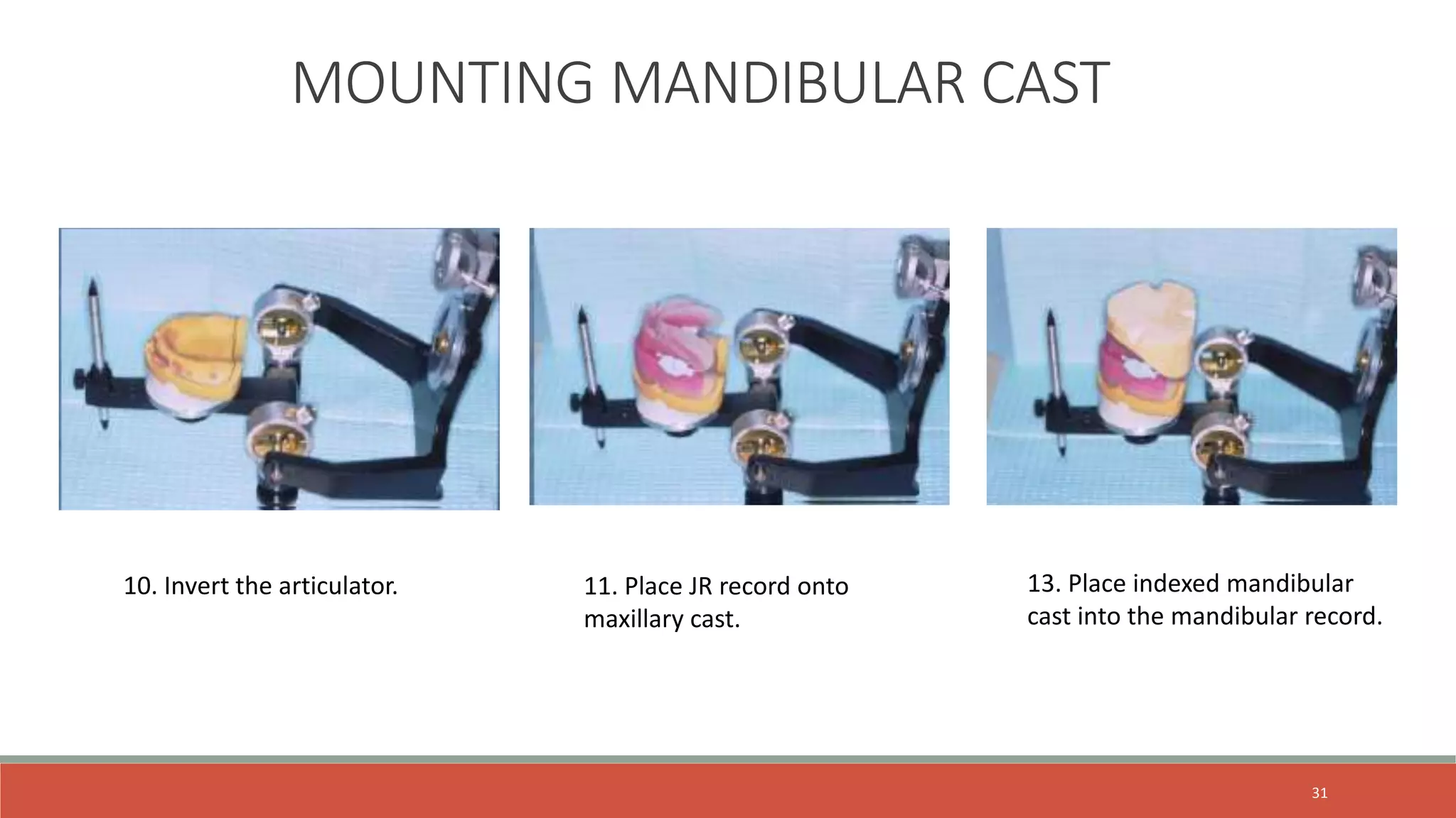 Hanau Wide Vue II Articulator | PPTX