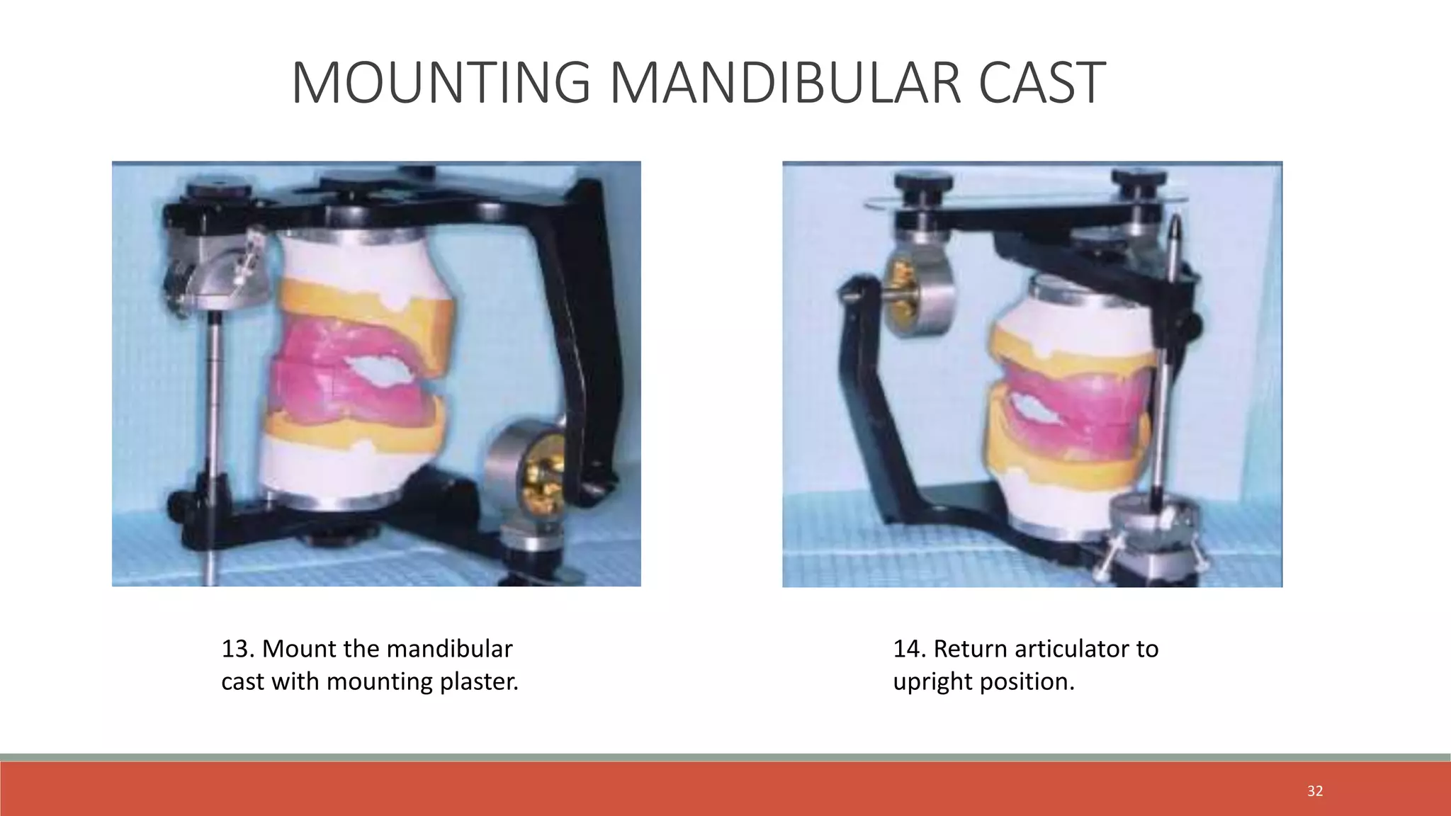 Hanau Wide Vue II Articulator | PPTX