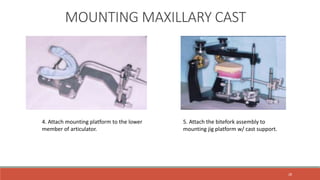 Hanau Wide Vue II Articulator | PPTX