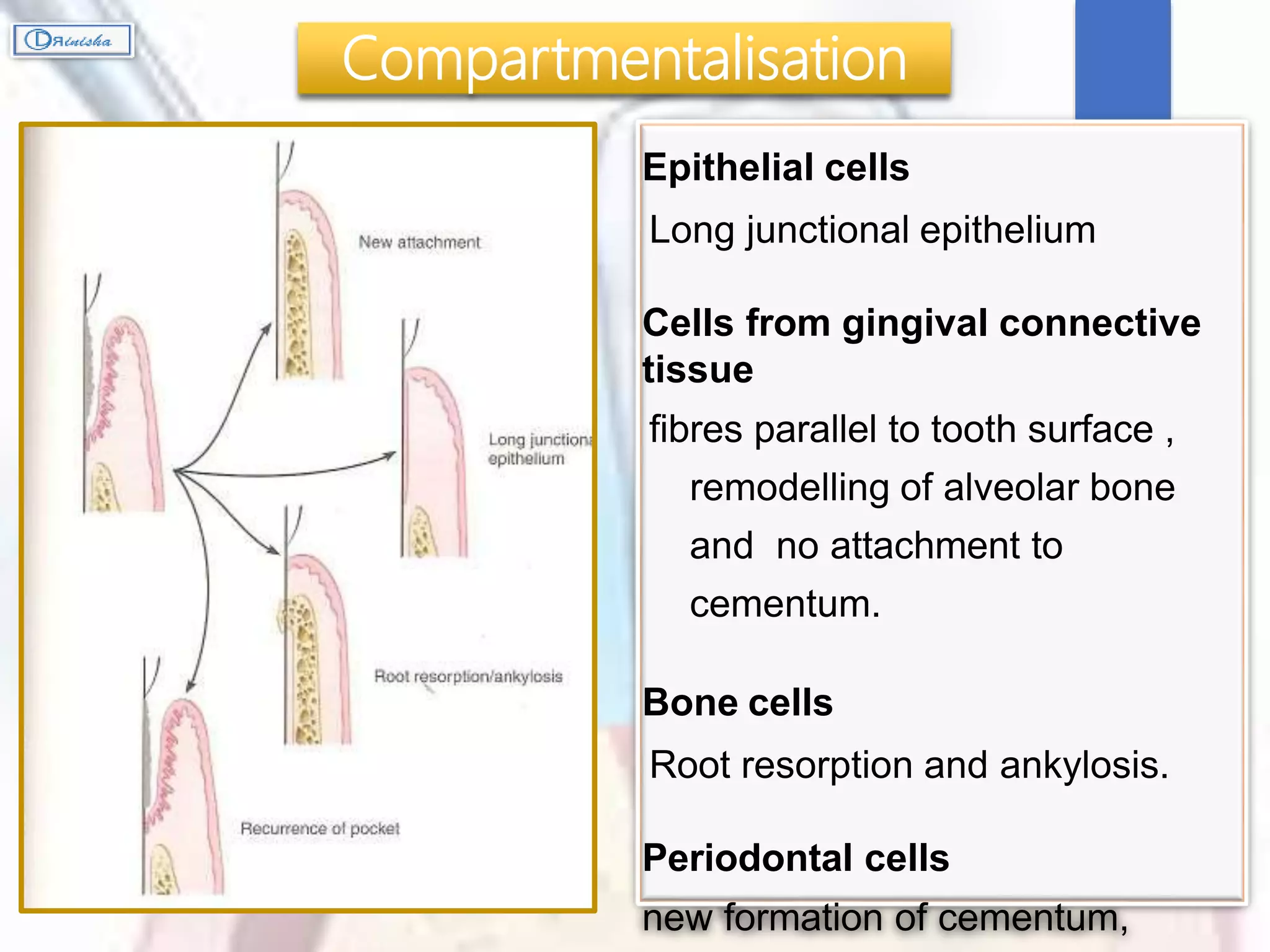 Guided Tissue Regeneration | PPTX