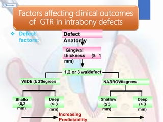 Guided Tissue Regeneration | PPTX