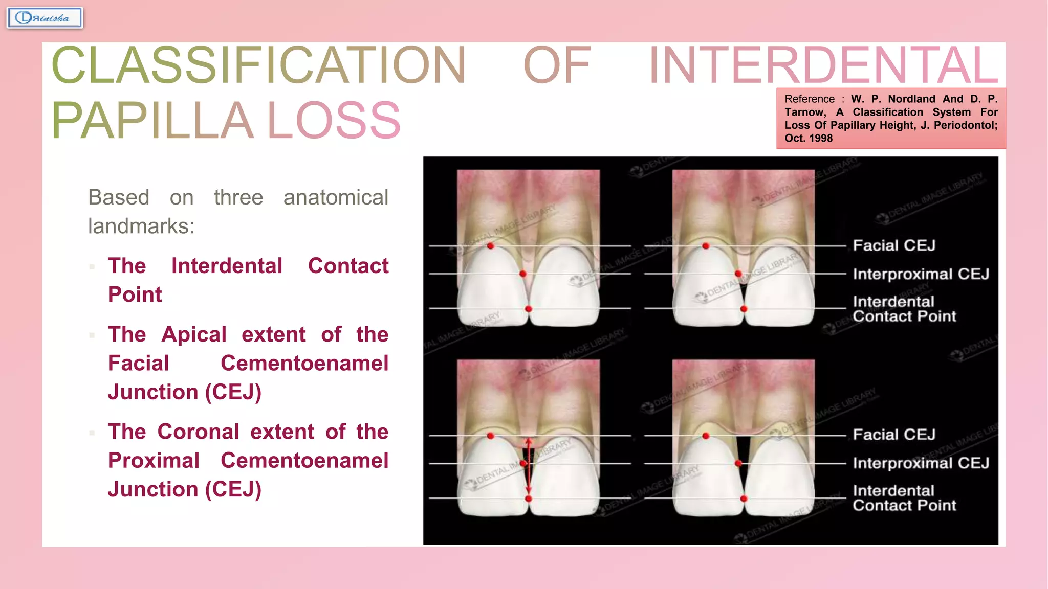 Papilla Preservation Techniques.pptx