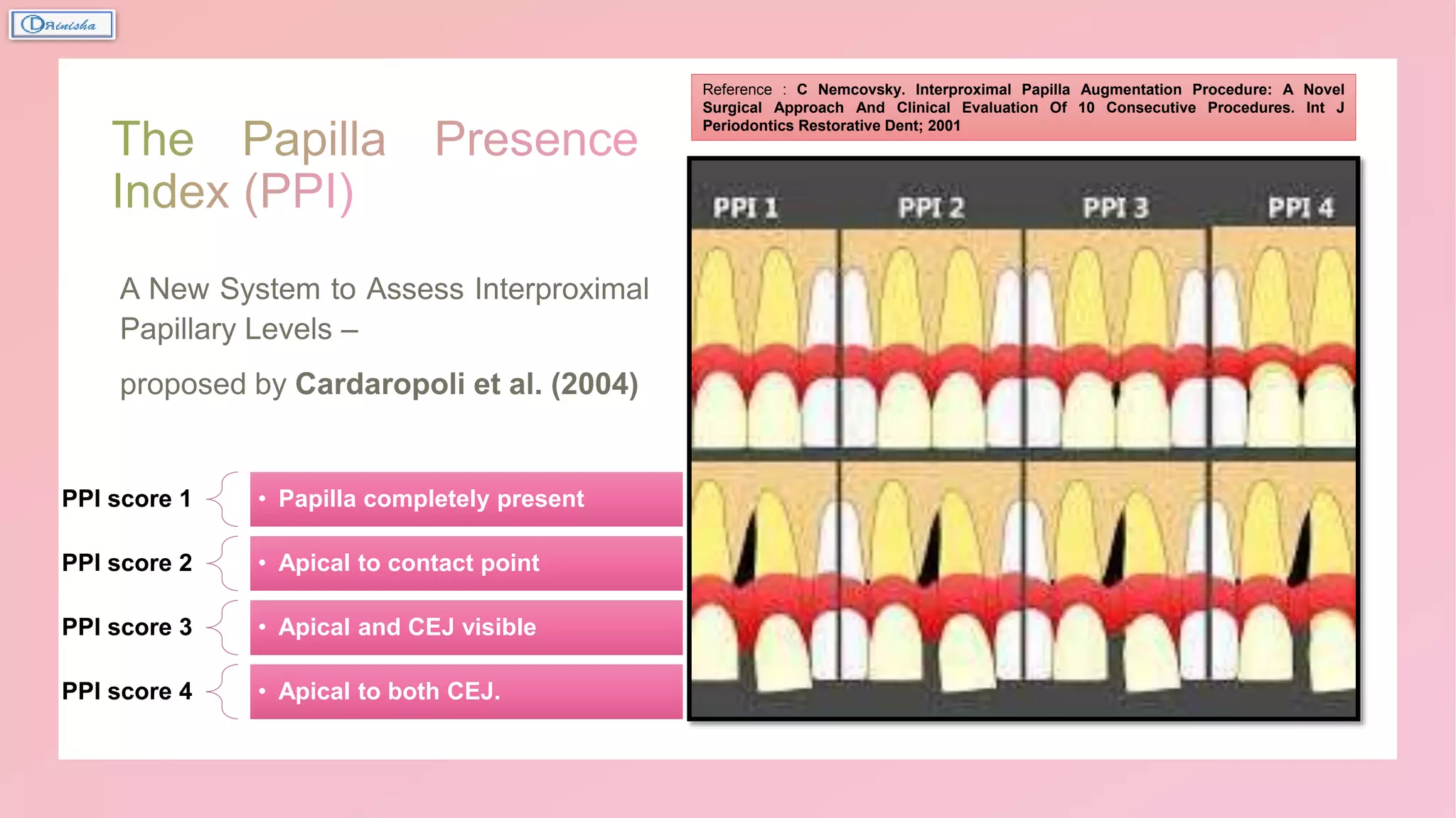 Papilla Preservation Techniques.pptx