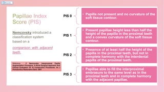 Papilla Preservation Techniques.pptx