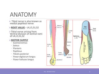 Tibial Nerve Injury
