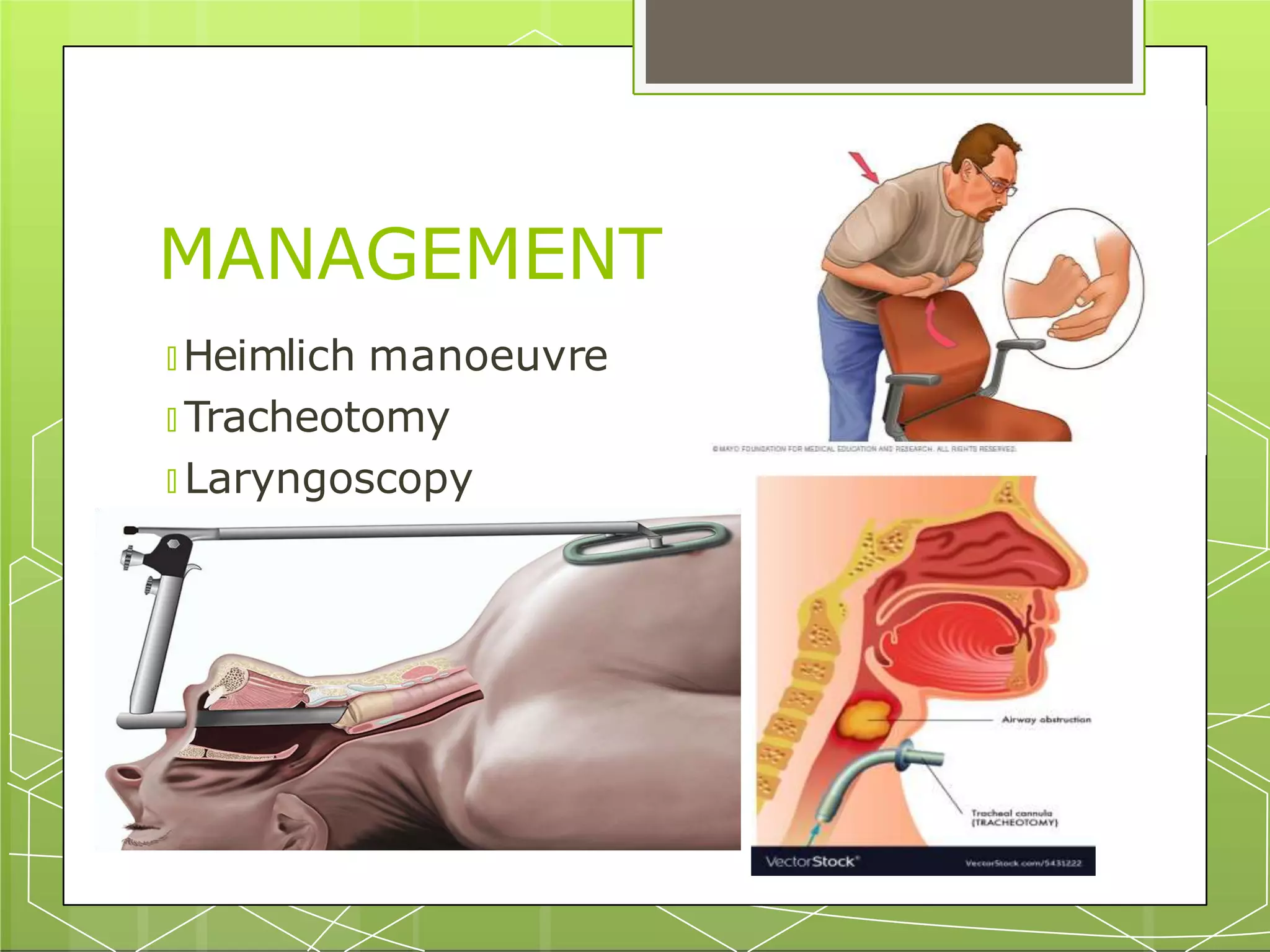 9. AIRWAY FOREIGN BODY.pptx