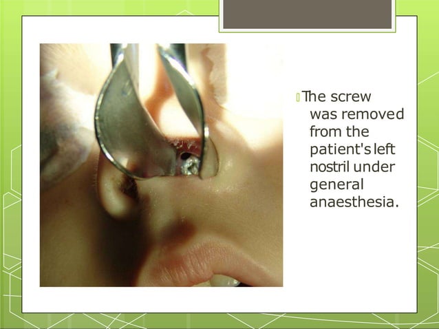 9. AIRWAY FOREIGN BODY.pptx