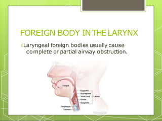 9. AIRWAY FOREIGN BODY.pptx
