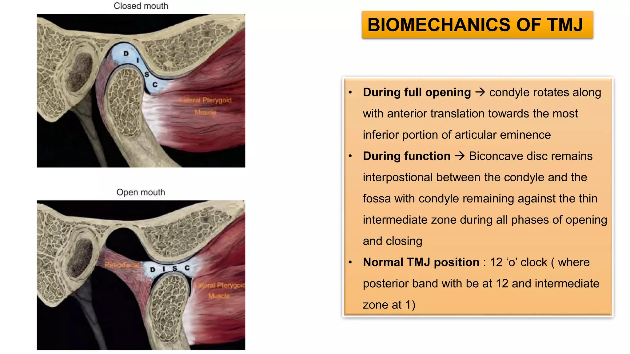 9. TMJ INTERNAL DERANGEMENT.pptx