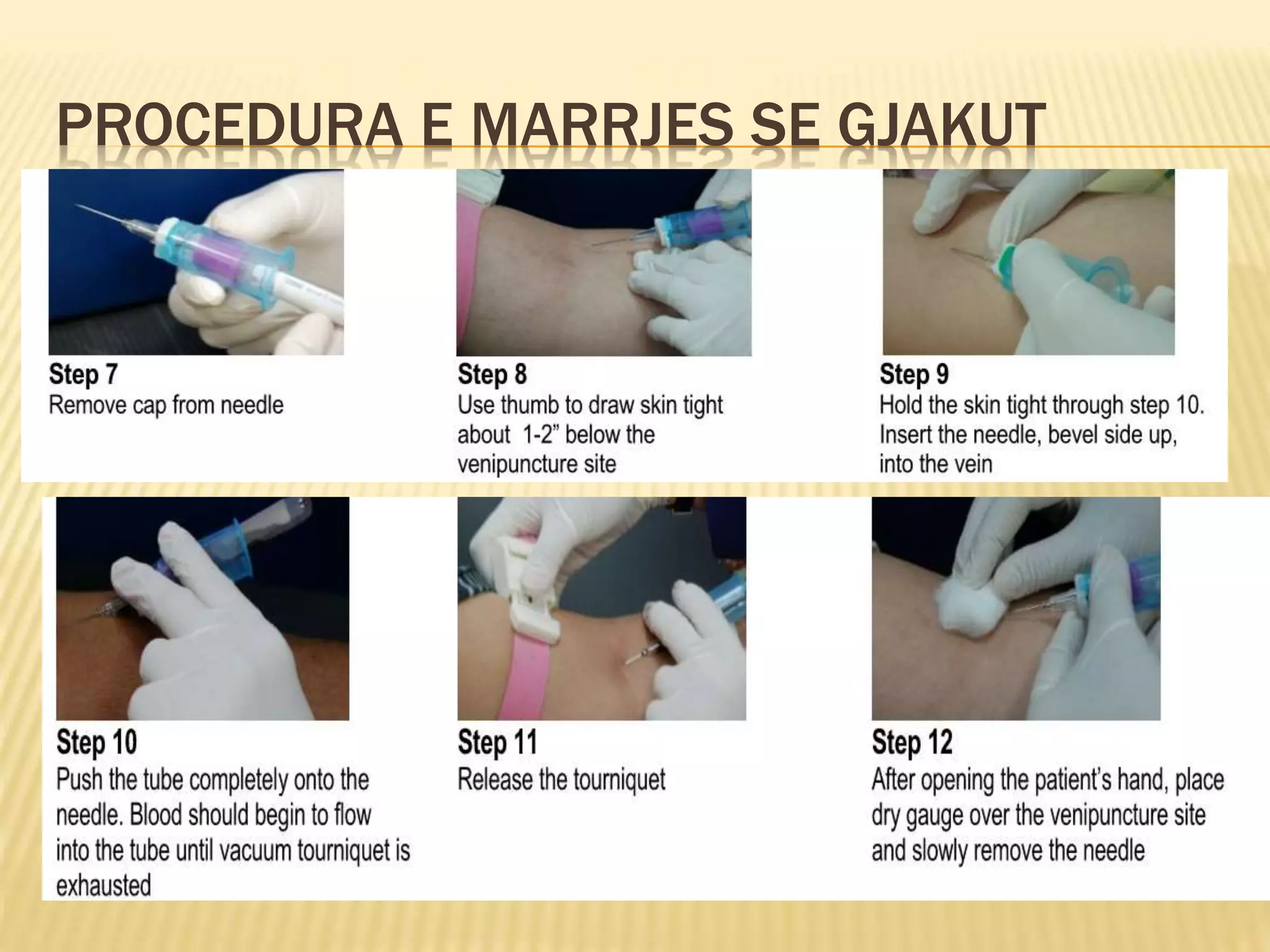 MARRJA E ANALIZAVE TE GJAKUT VENOZ,ARTERIAL DHE KAPILAR.pptx