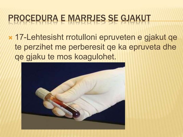 MARRJA E ANALIZAVE TE GJAKUT VENOZ,ARTERIAL DHE KAPILAR.pptx