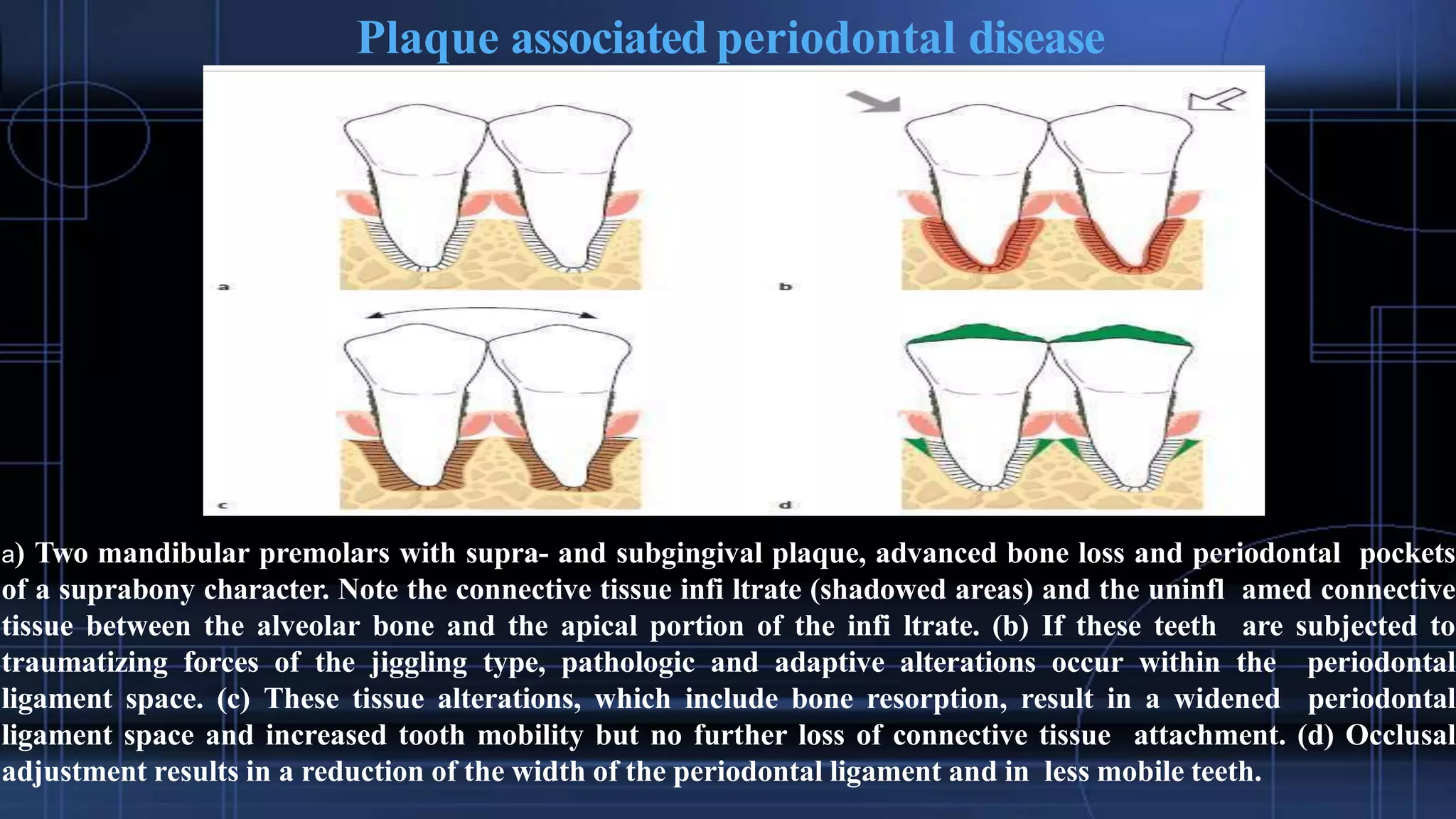 9. TRAUMA FROM OCCLUSION PPT.pptx