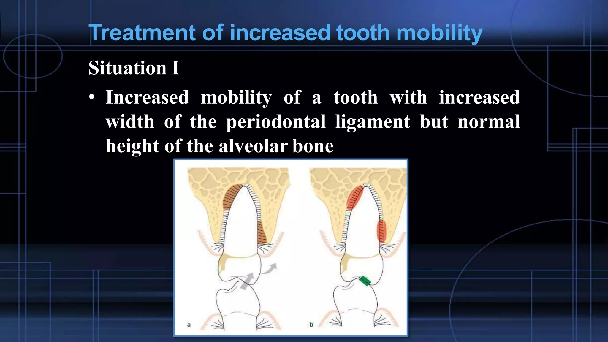 9. TRAUMA FROM OCCLUSION PPT.pptx