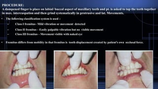 9. TRAUMA FROM OCCLUSION PPT.pptx