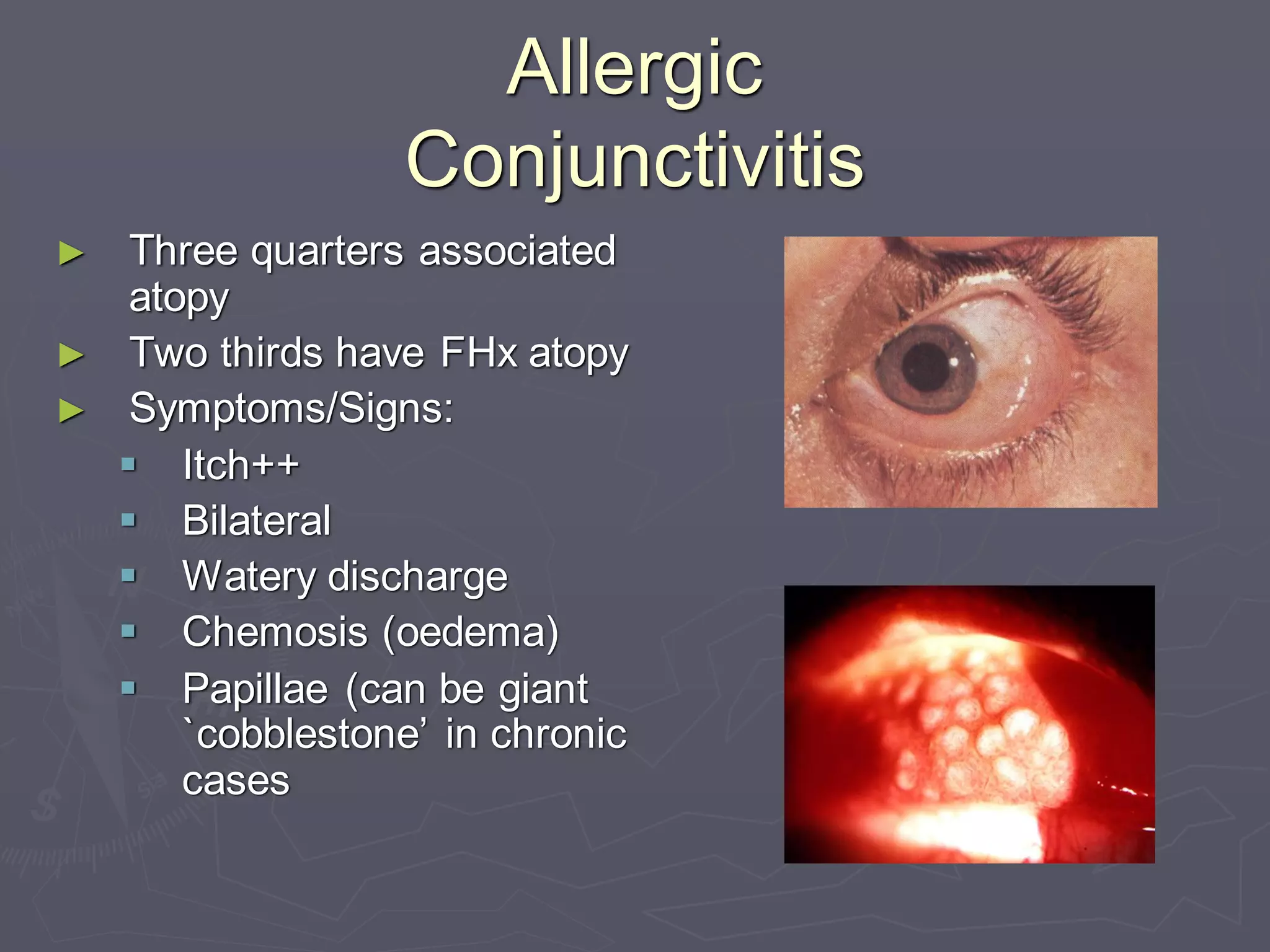 9. acute red eye.pdf