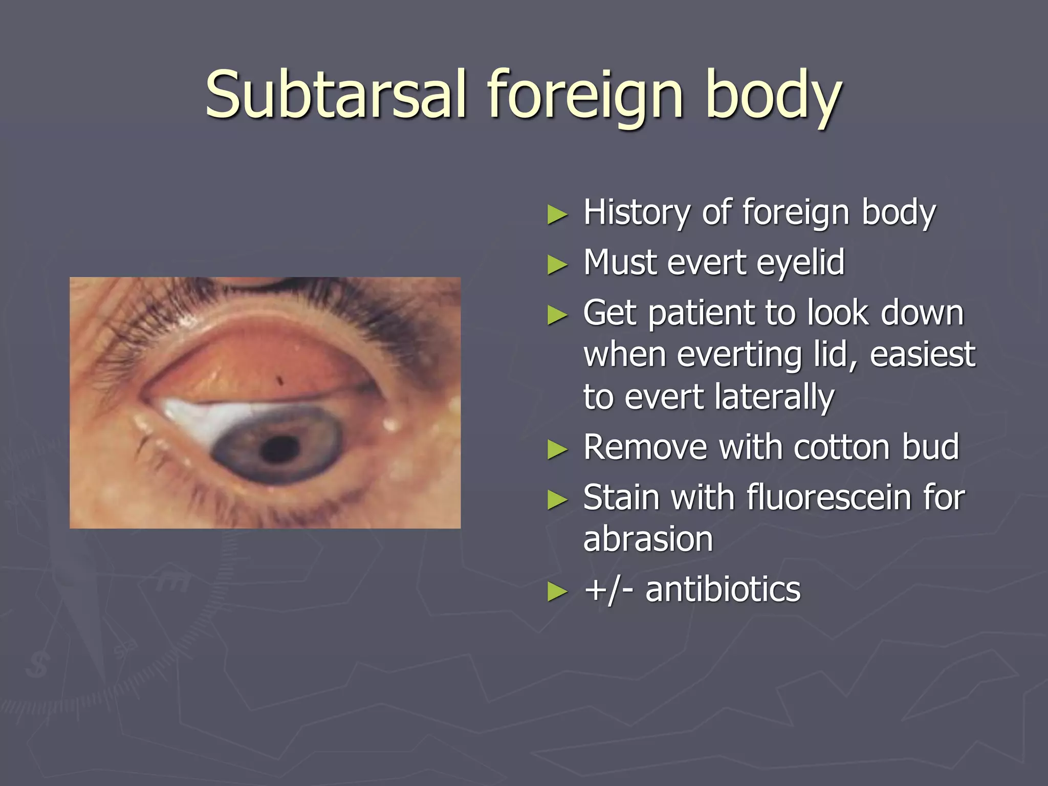 9. acute red eye.pdf