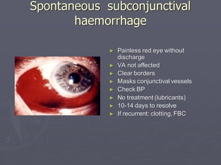 9. acute red eye.pdf