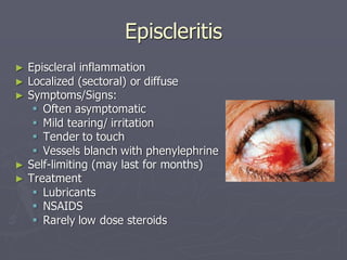 9. acute red eye.pdf