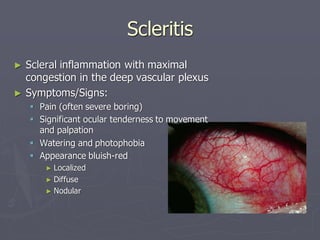 9. acute red eye.pdf