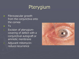 9. acute red eye.pdf