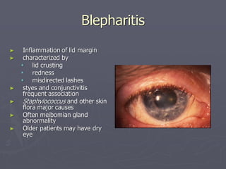 9. acute red eye.pdf