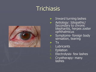 9. acute red eye.pdf