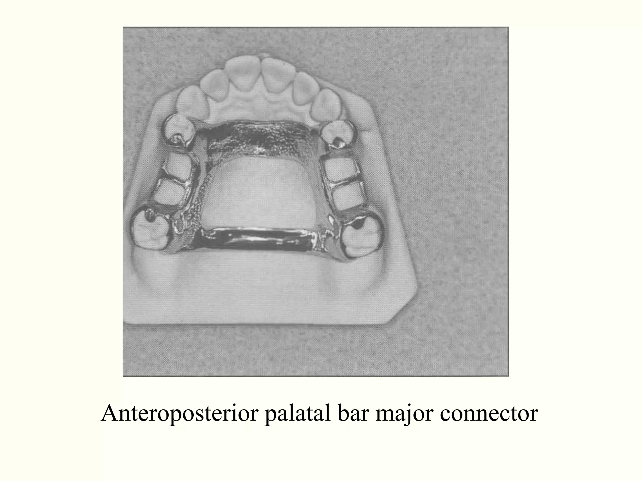 9.MAJOR CONNECTORS.pptx