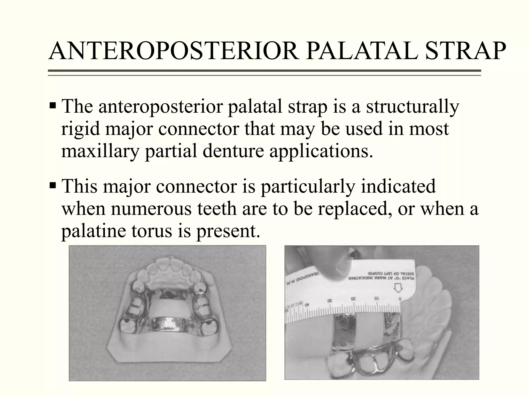 9.MAJOR CONNECTORS.pptx