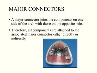 9.MAJOR CONNECTORS.pptx