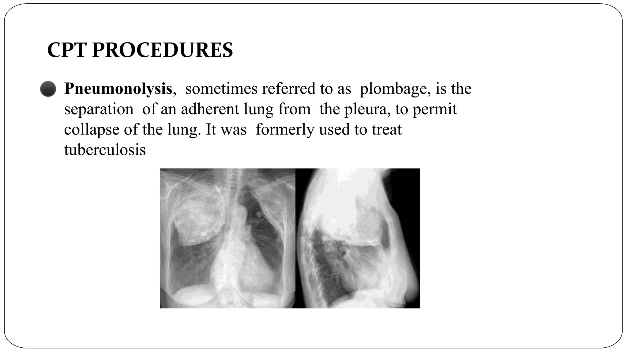 9. RESPIRATORY SYSTEM.pptx.pdf