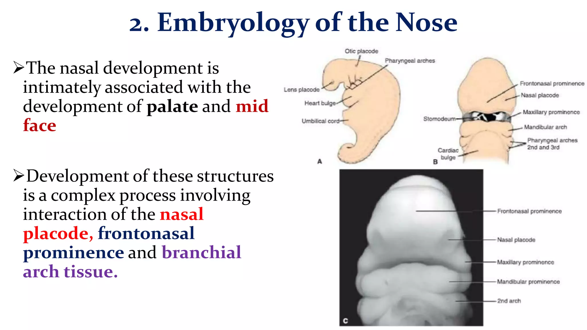 9. Anatomy of the Nose and Paranasal sinuses, Dr. Maxprince.pptx