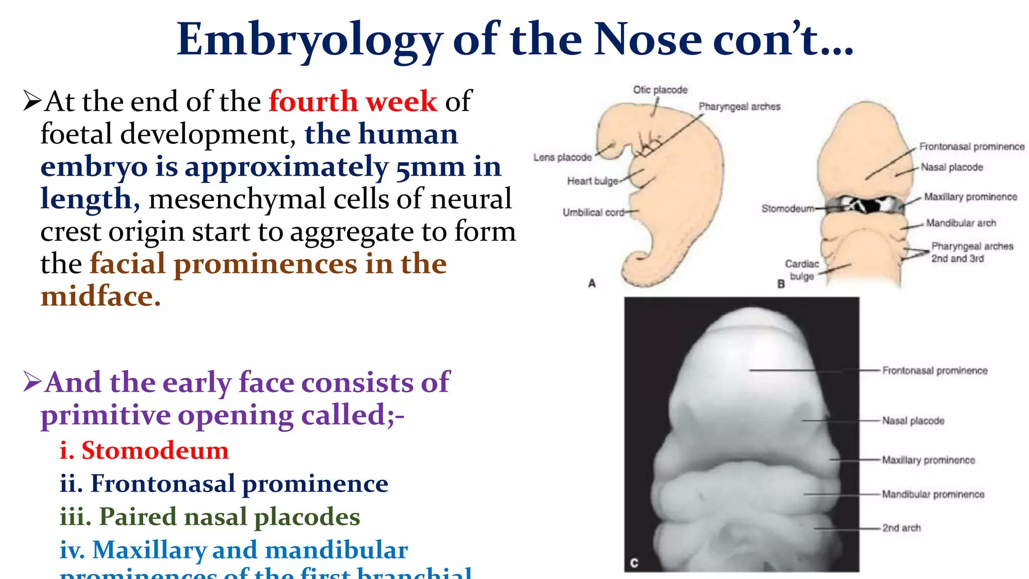 9. Anatomy of the Nose and Paranasal sinuses, Dr. Maxprince.pptx