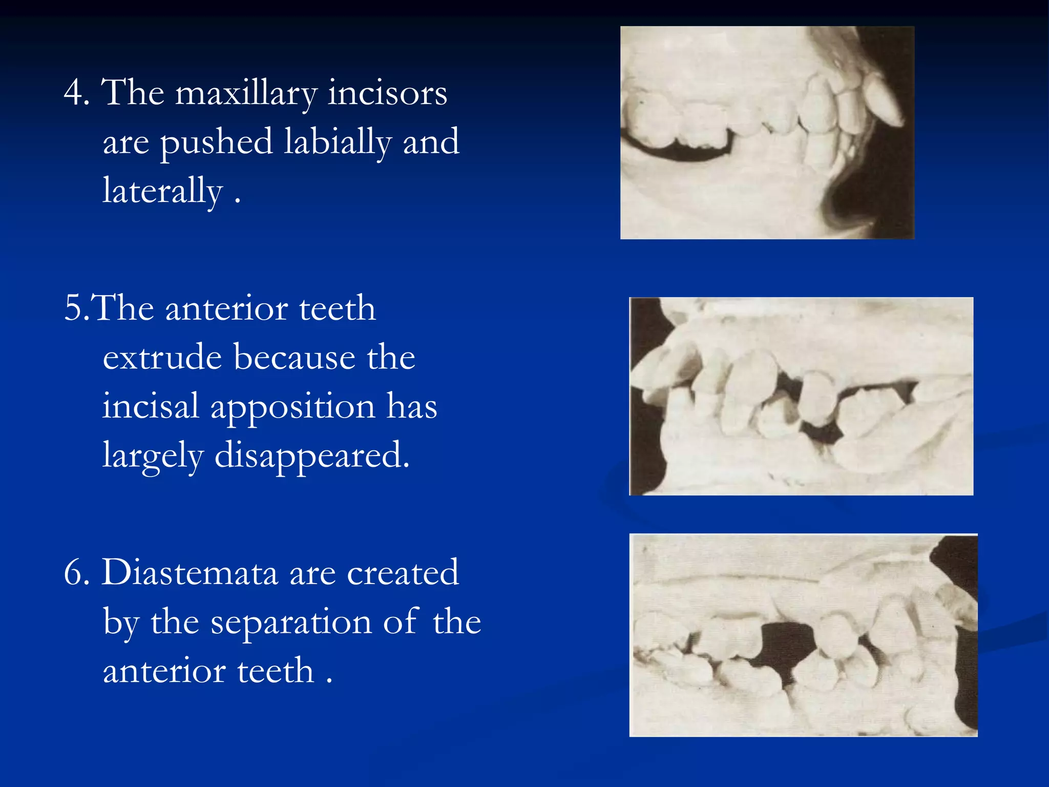 9.Tooth mobility.ppt | Dental Health | Diseases and Conditions