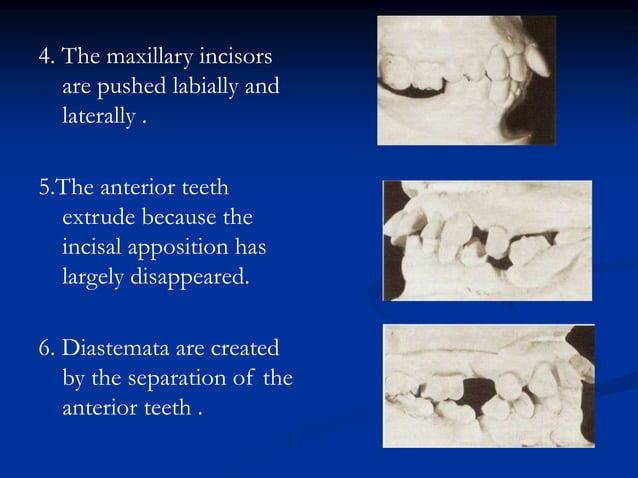 9.Tooth mobility.ppt | Dental Health | Diseases and Conditions