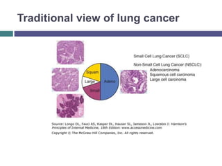 9. Lung ca.pptx