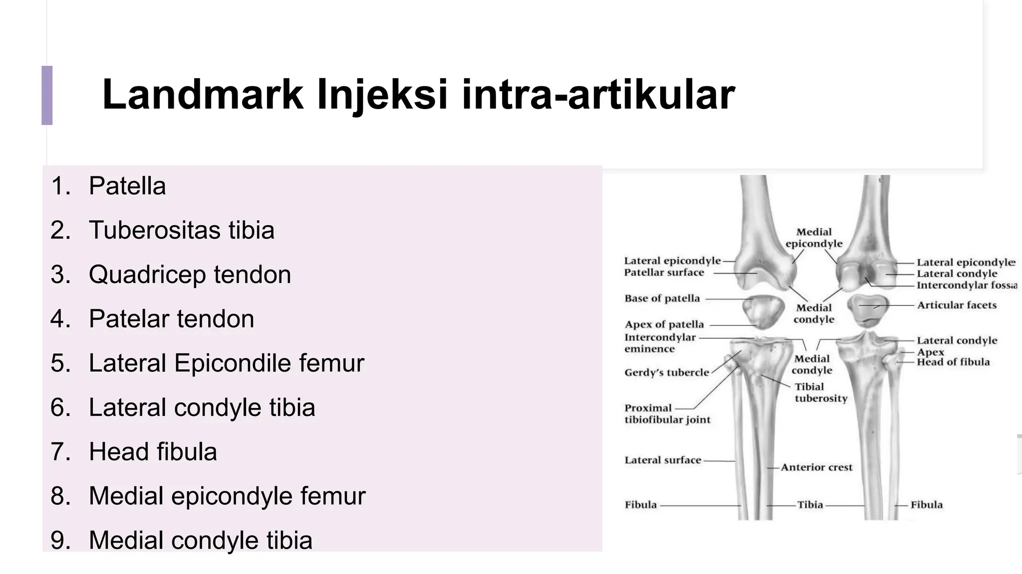 9. Intra Articular Injection.pptx