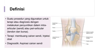 9. Intra Articular Injection.pptx